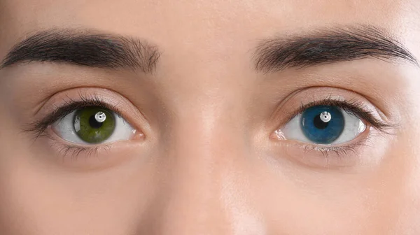 Little Girl Different Colors Eyes Closeup Heterochromia Iridis — Stock ...