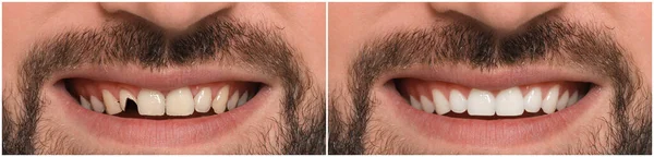 Perfect male teeth Stock Photos, Royalty Free Perfect male teeth Images ...