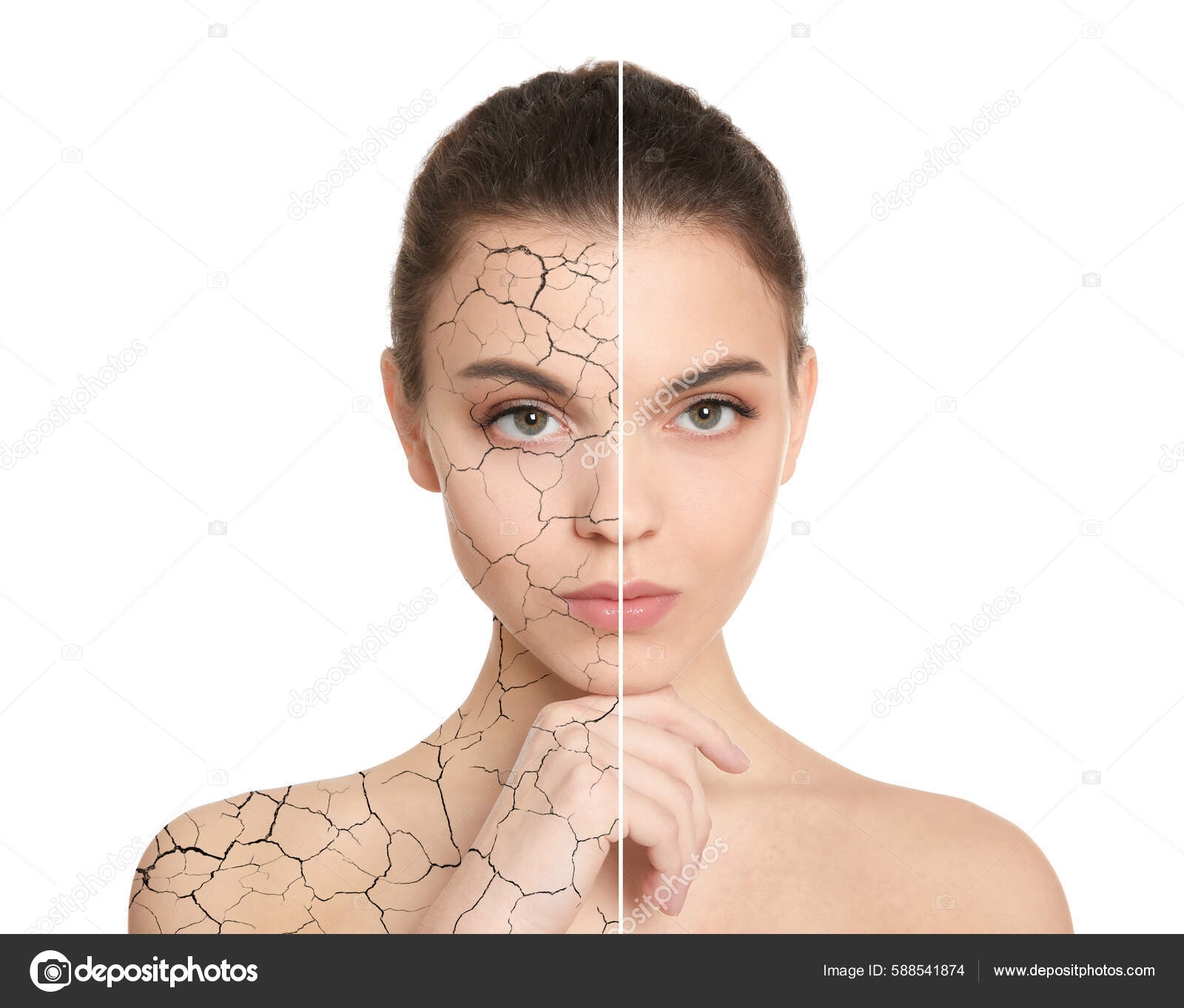 Collage Photos Woman Having Dry Skin Problem Dry Skin Problem Stock ...