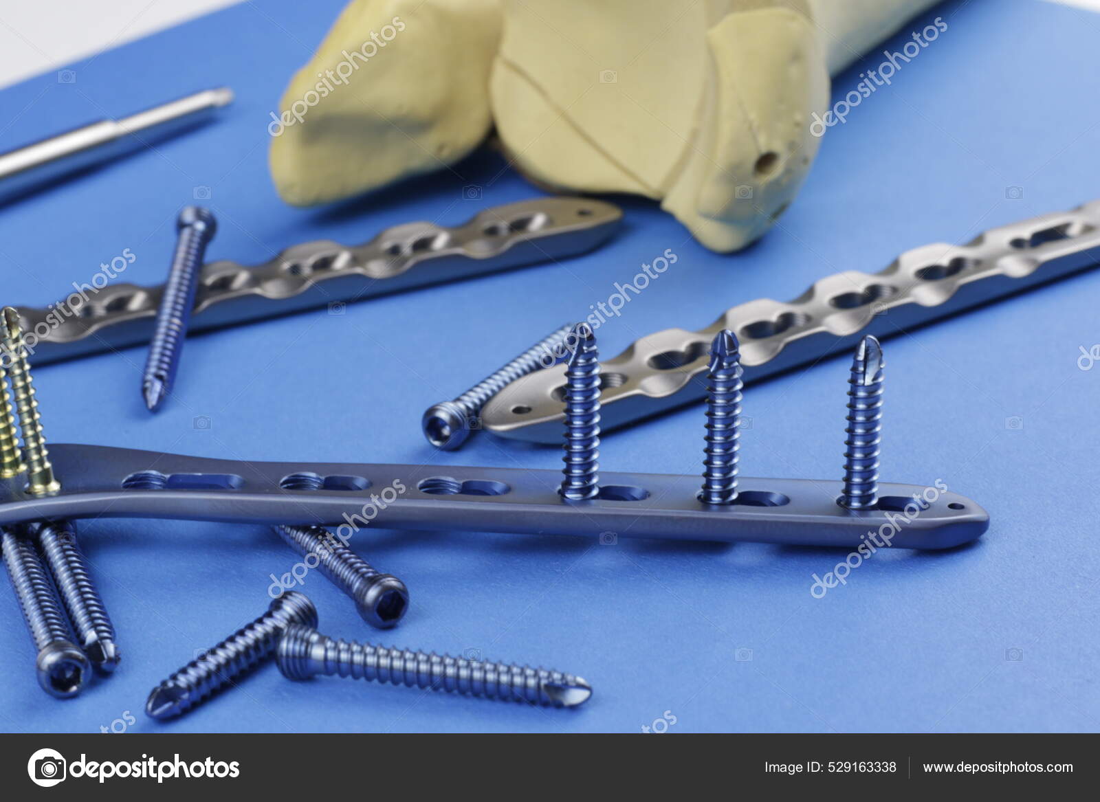 Surgical Arm Plates