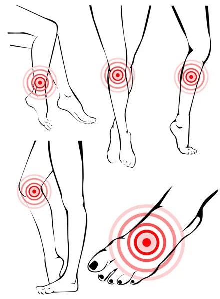 Leg, Royalty-free Leg Vector Images & Drawings | Depositphotos®