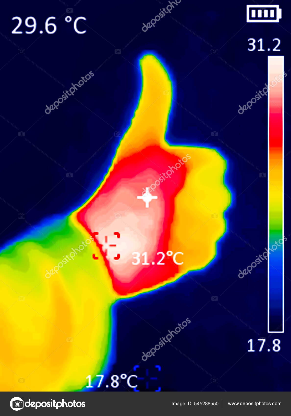 Thermographic Image Person's Hand Showing Different Temperatures ...
