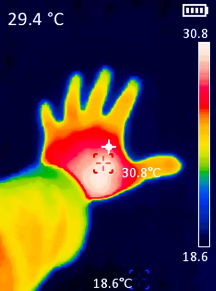 Thermograph Stock Photos, Royalty Free Thermograph Images | Depositphotos