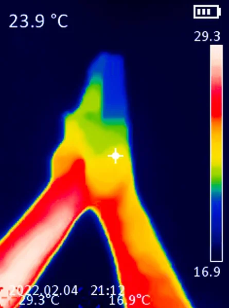 Thermographic Image Hand Human Heart Showing Different Temperatures ...