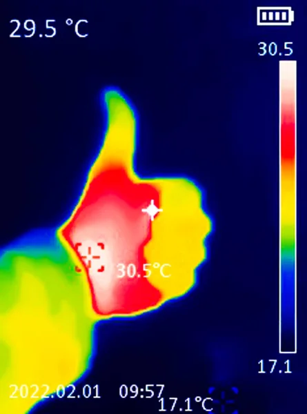 Thermographic Image Hand Human Heart Showing Different Temperatures ...