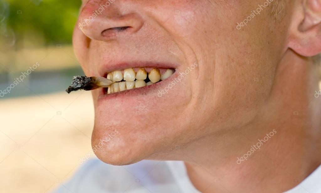 Boca con dientes afectados por la nicotina: fotografía de stock ...