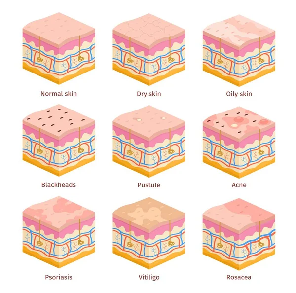 292 Skin cross section Stock Illustrations | Depositphotos®