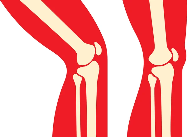 Vectores de stock de Rodilla, ilustraciones de Rodilla sin royalties ...