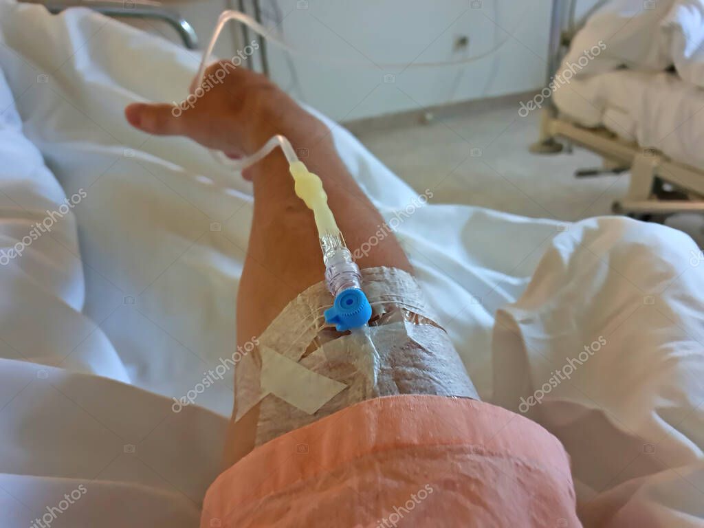 Catéter venoso periférico en la vena de la mano humana. Terapia médica ...