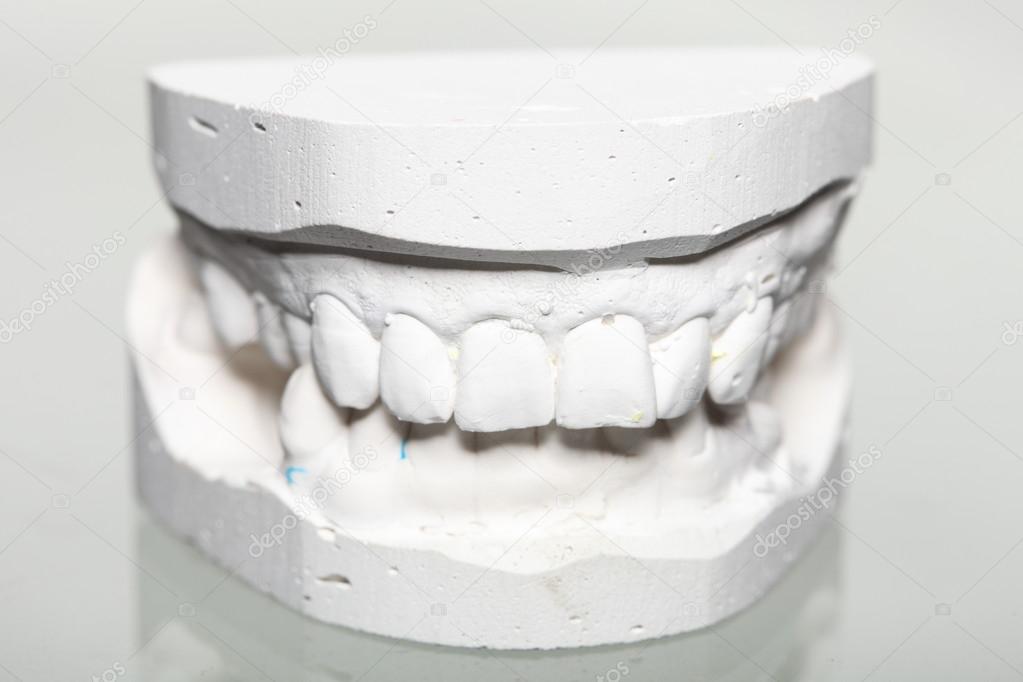 Dental Gips Modell Form der Zähne in Gips — Stockfoto © Voyagerix #29978717