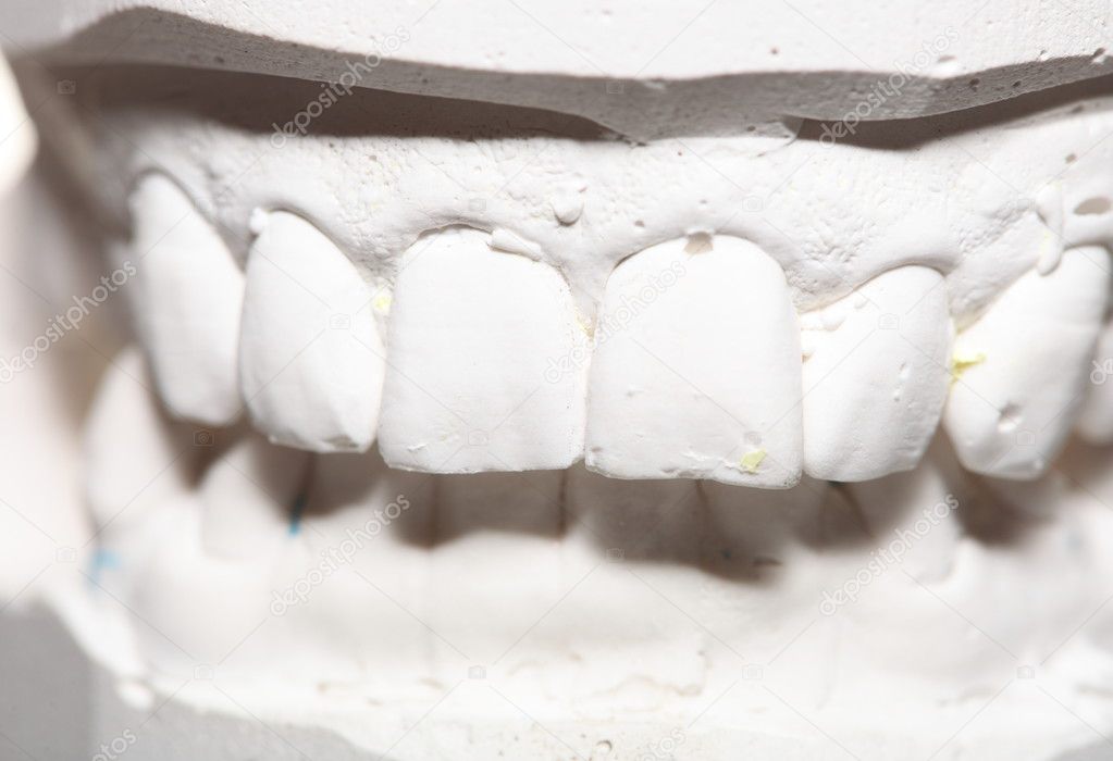 Tandgips modell form av tänder i gips — Stockfotografi © Voyagerix ...