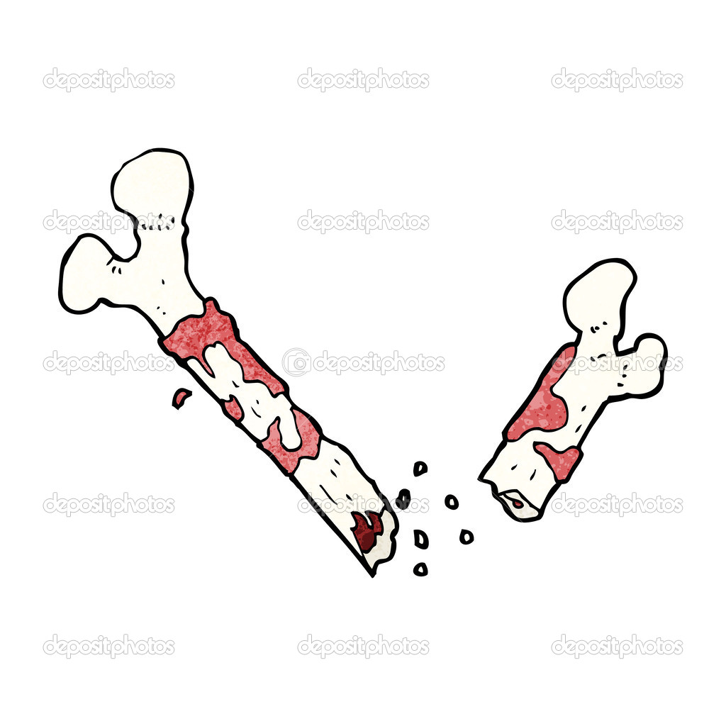 Gross broken bone cartoon Stock Vector Image by ©lineartestpilot #39430941