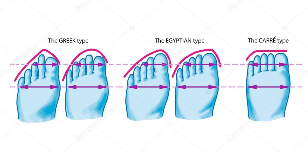 Three types of foot shape - greek, egyptian, square, carre types - the ...