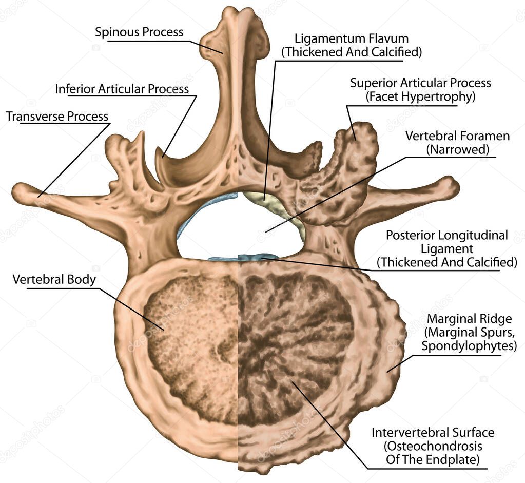 Second lumbar vertebra, lumbar spine, vertebral bone, vertebra ...