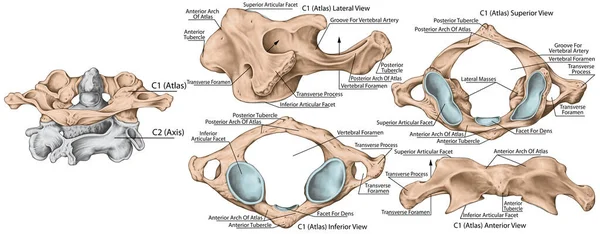 Axis Vertebra Anterior View