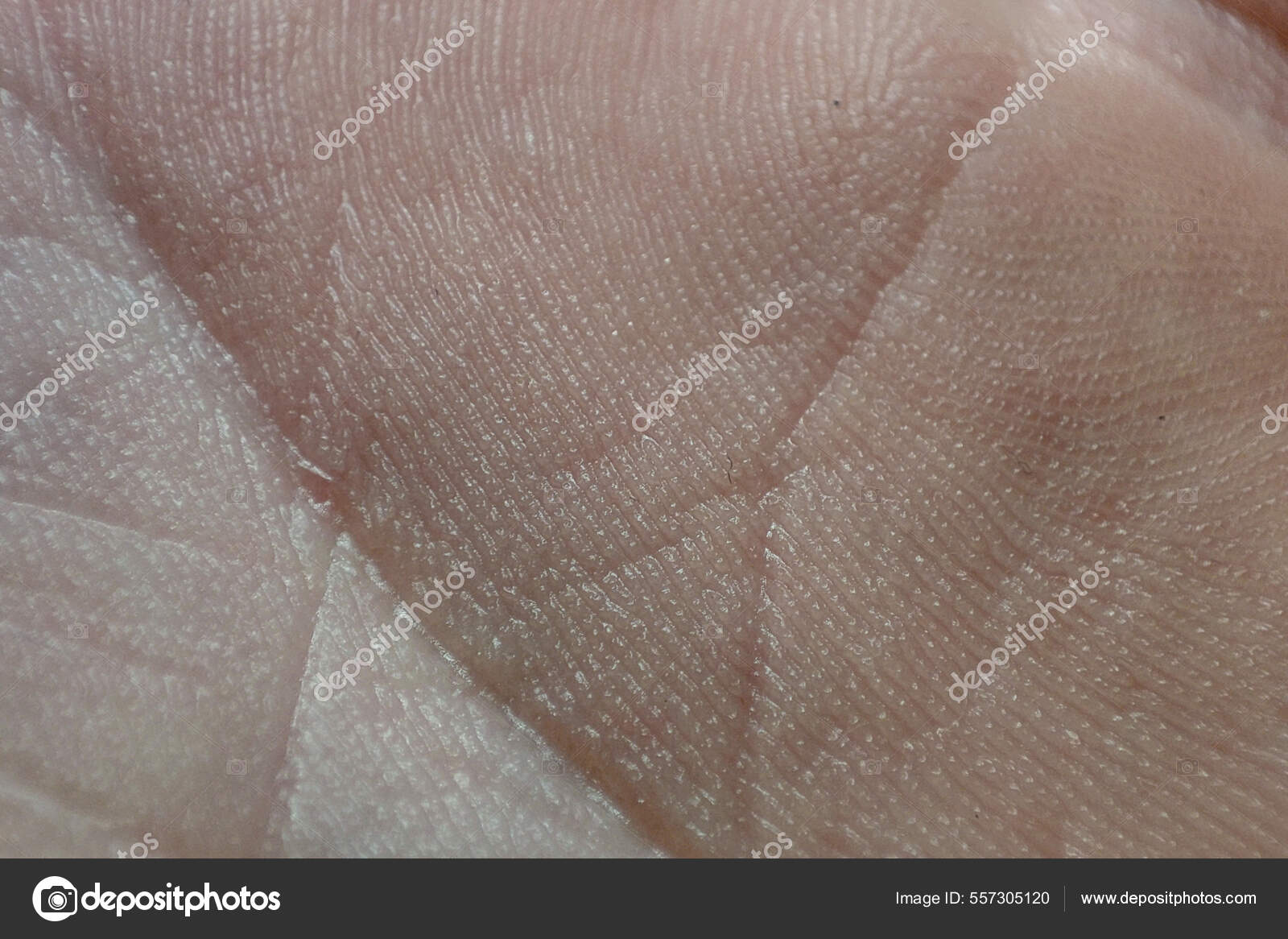 Human Skin Macro Human Hand Dermatology Concept Healthy Skin Texture ...
