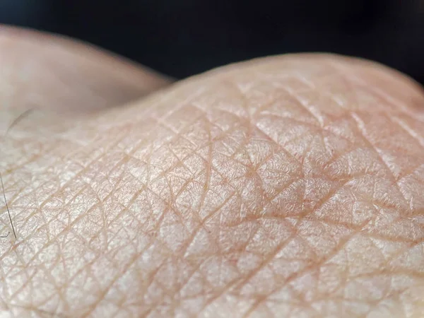 Skin texture Images - Search Images on Everypixel