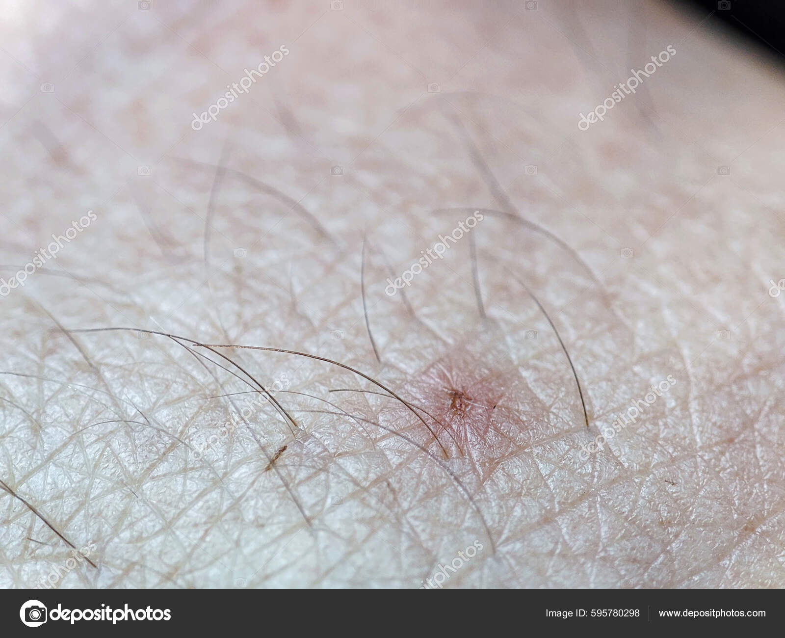 Close Human Hand Macro Skin Texture Closeup Hand — Stock Photo © photo ...