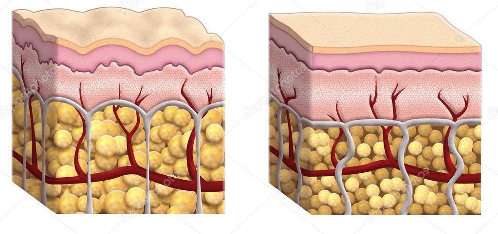 Cellulite cross section — Stock Photo © jamesgroup #13483224