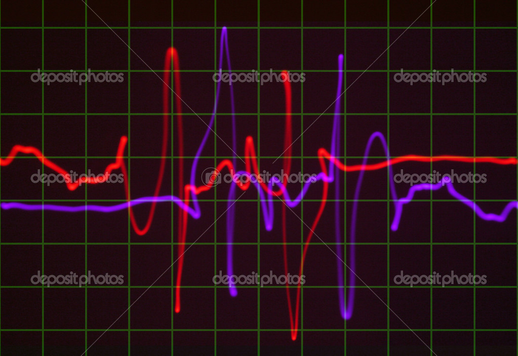 Pulses Stock Photo by ©dubassy 12799565