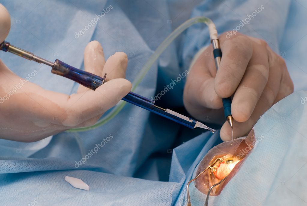 Eye surgery — Stock Photo © Bork #29595701