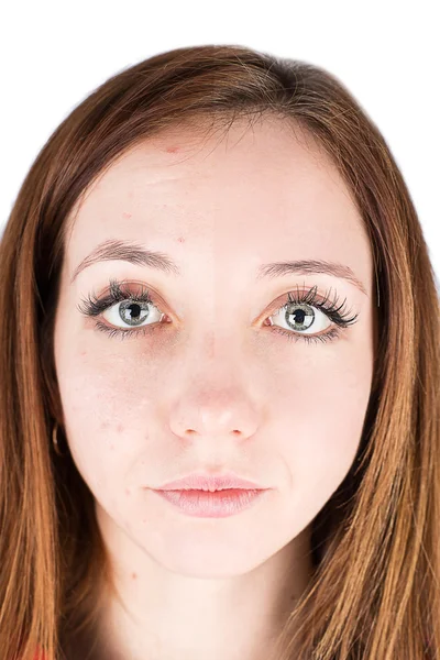 Woman with pimples Stock Photos, Royalty Free Woman with pimples Images ...