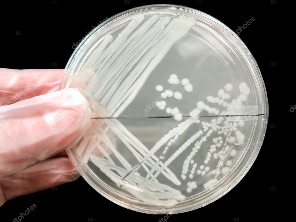 Agar Plate Streak