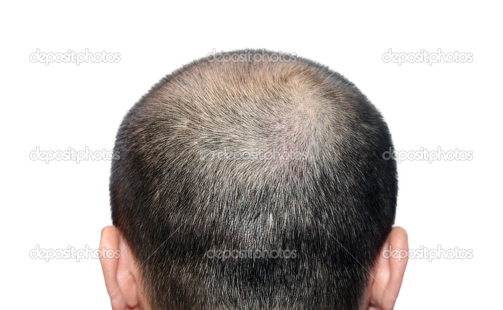 Cabeza calva: fotografía de stock © aoo8449 #49134109 | Depositphotos