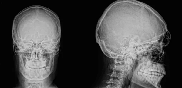 Asian ct scan Stock Photos, Royalty Free Asian ct scan Images ...