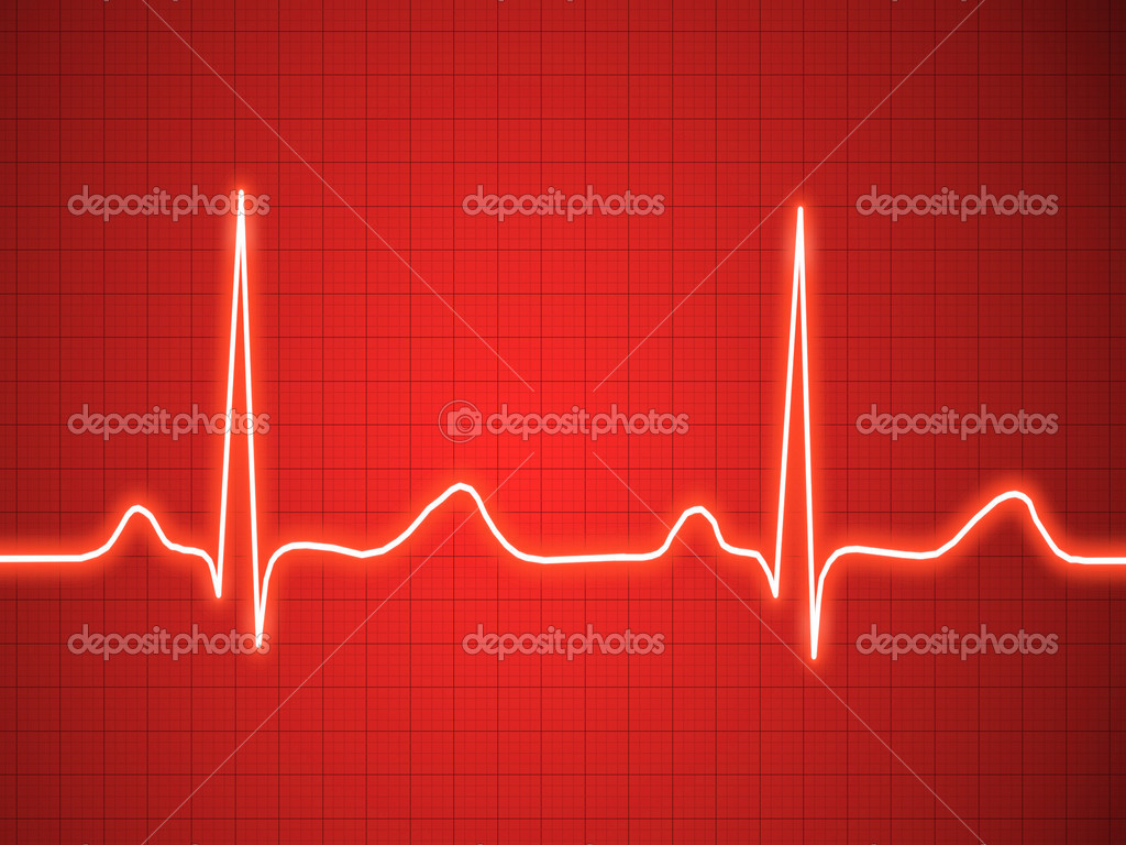 Electrocardiograma, ecg, gráfico, trazado de pulso — Foto de stock ...