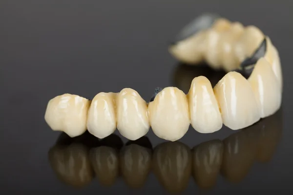 Porcelain teeth - dental bridge — Stock Photo © Lighthunter #29224667