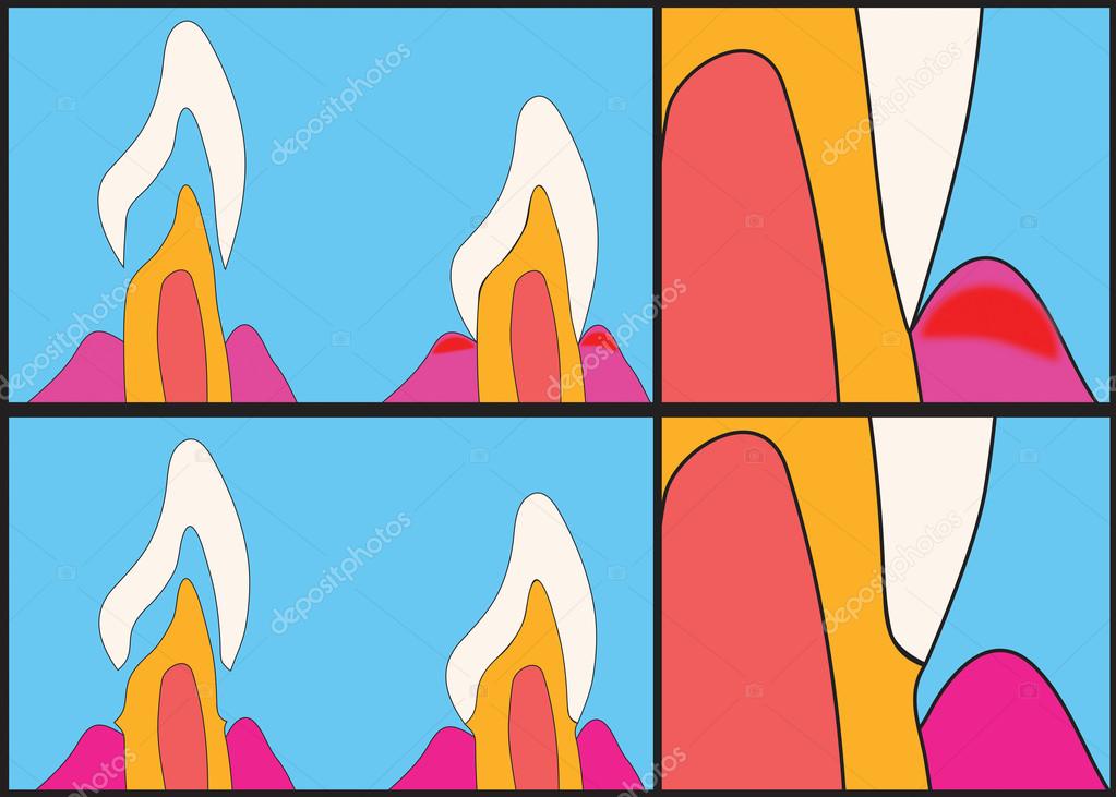 Buffing Teeth Tangent or Shoulder Way. Stock Illustration by ...