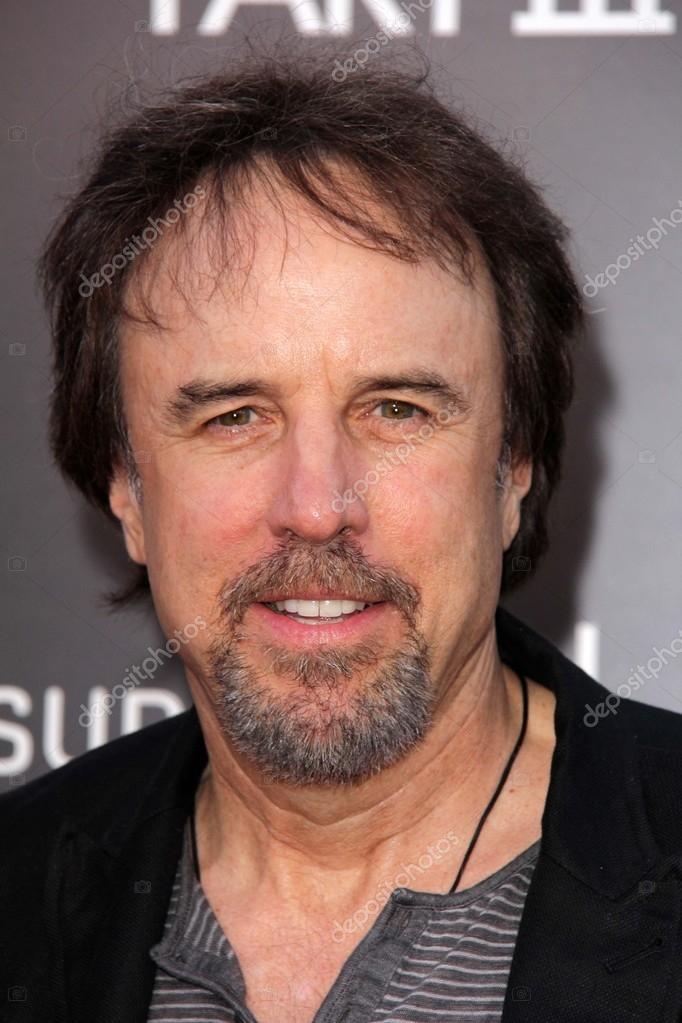 Kevin Nealon Hair Transplant