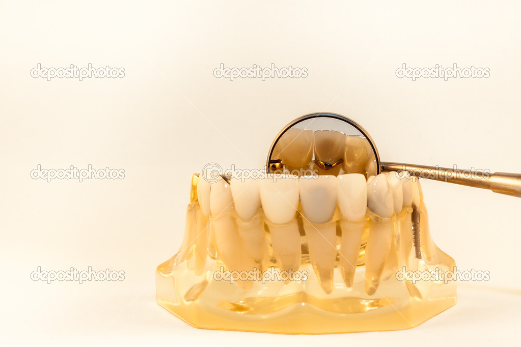 Anterior cemented PFM crown on model on white background Stock Photo by ...
