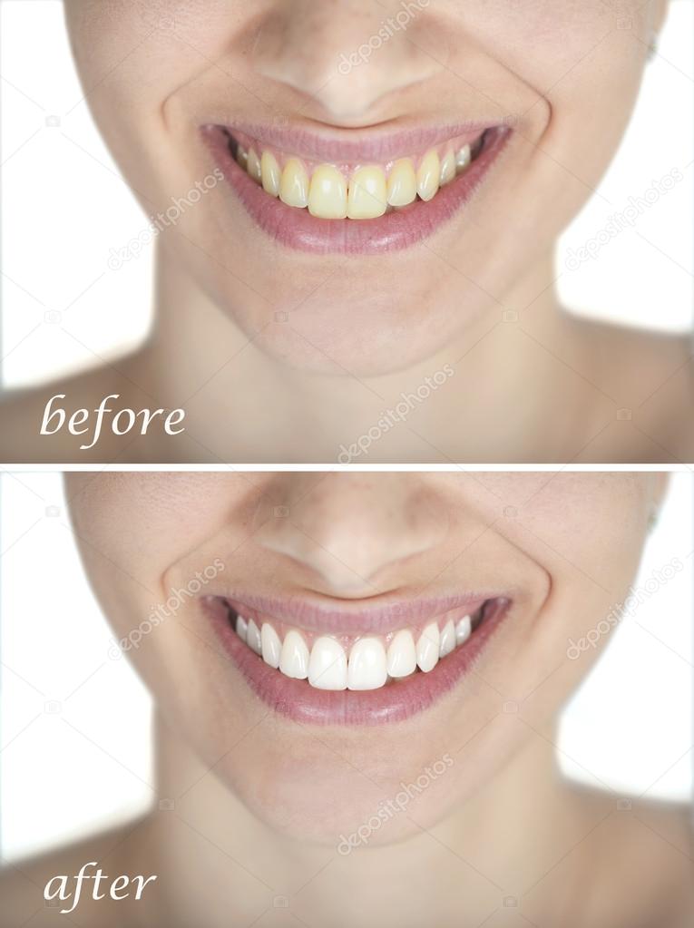 Bleaching — Stock Photo © seb_ra #42602531