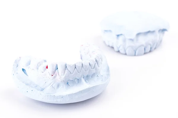 Teeth mold Stock Photos, Royalty Free Teeth mold Images | Depositphotos