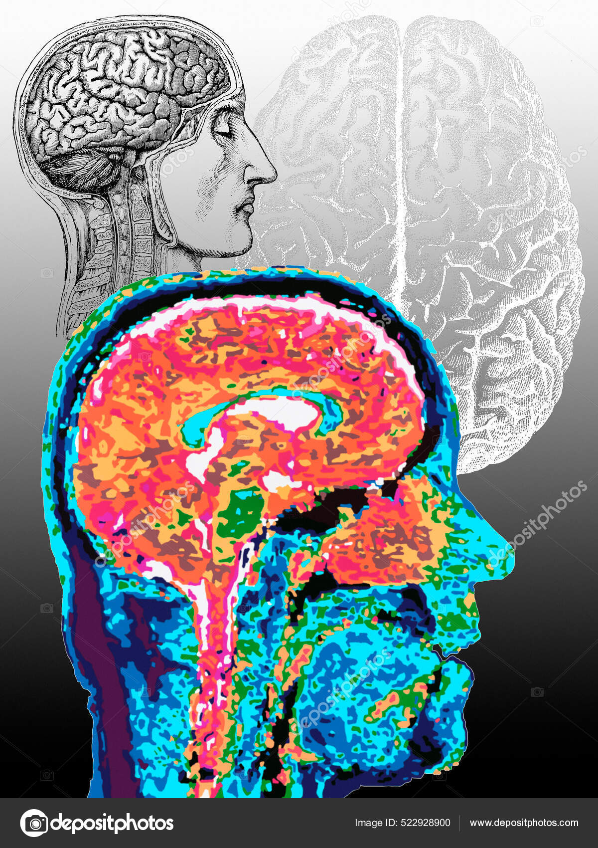 Neuroimaging Brain Imaging Brain Mapping Use Techniques Computed ...