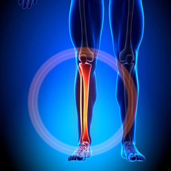 Tibia Bone Pain