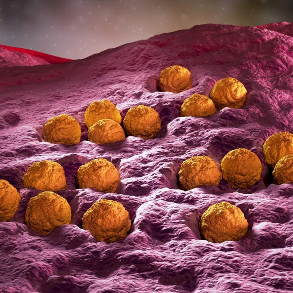 Rubella Stock Photos, Royalty Free Rubella Images | Depositphotos