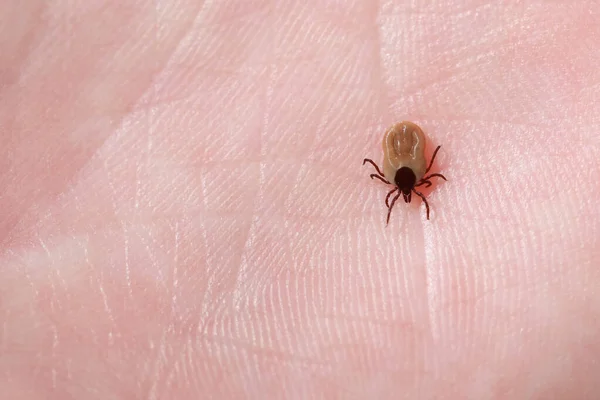 Ticks on images libres de droit, photos de Ticks on | Depositphotos