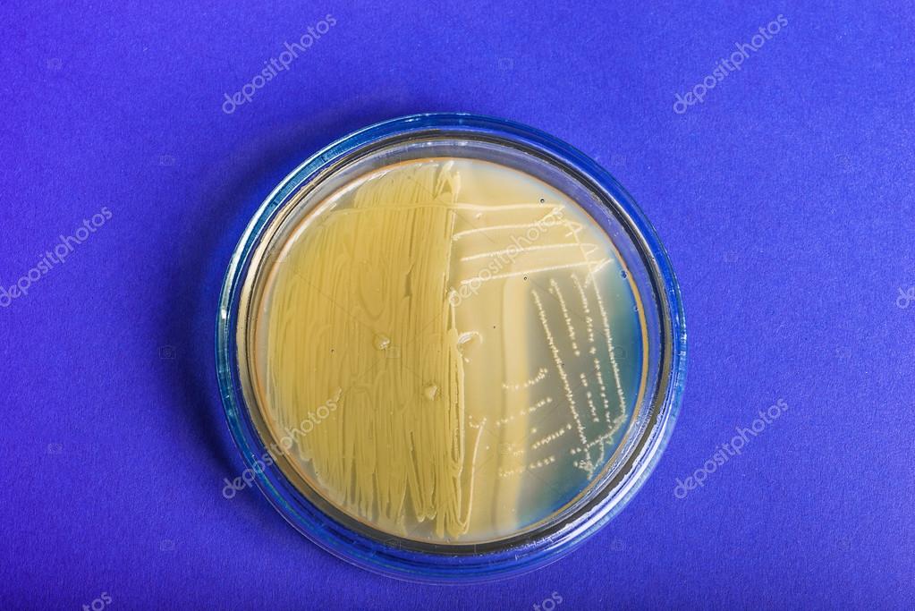 Petri dish with bacteria (Streptococcus) on agar. — Stock Photo ...