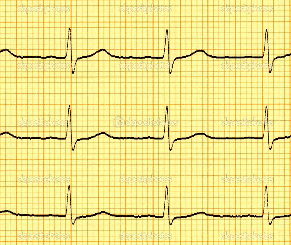 Electrocardiogram (ecg) Stock Photo by ©egluteskarota 18694055