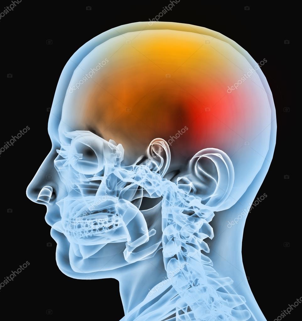 Radiography body part Stock Photo by ©Giovanni_Cancemi 21670881