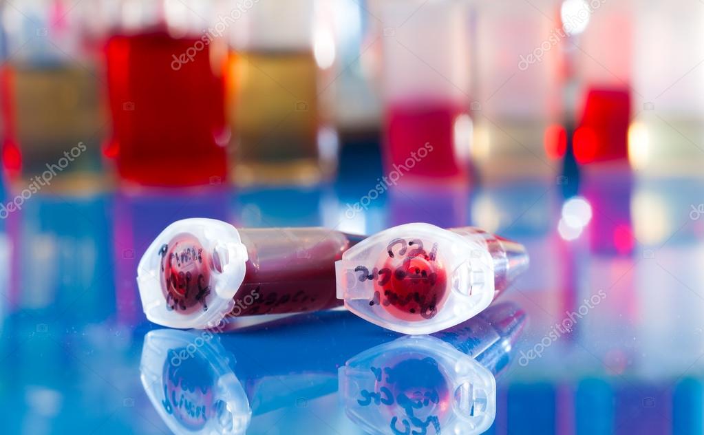 Sample of stem cells in the reaction tube Stock Photo by ©motorolka ...