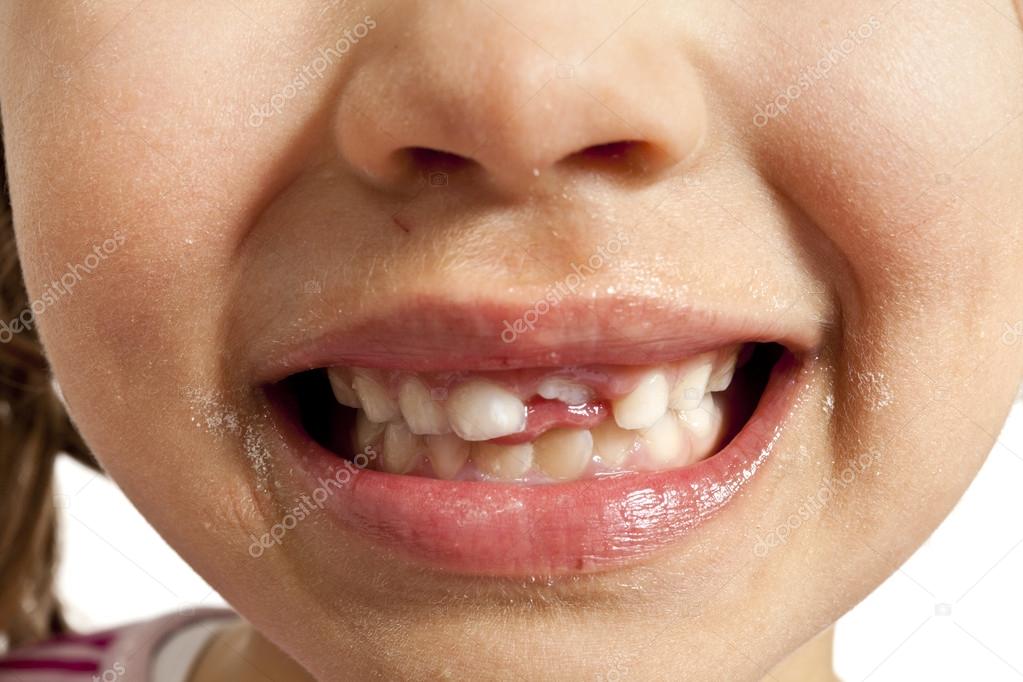 Child, mouth — Stock Photo © Zveiger #35649167