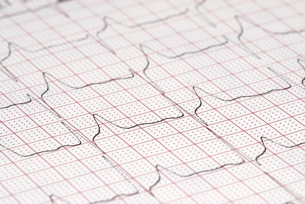 Normal heart rate Stock Photos, Royalty Free Normal heart rate Images ...