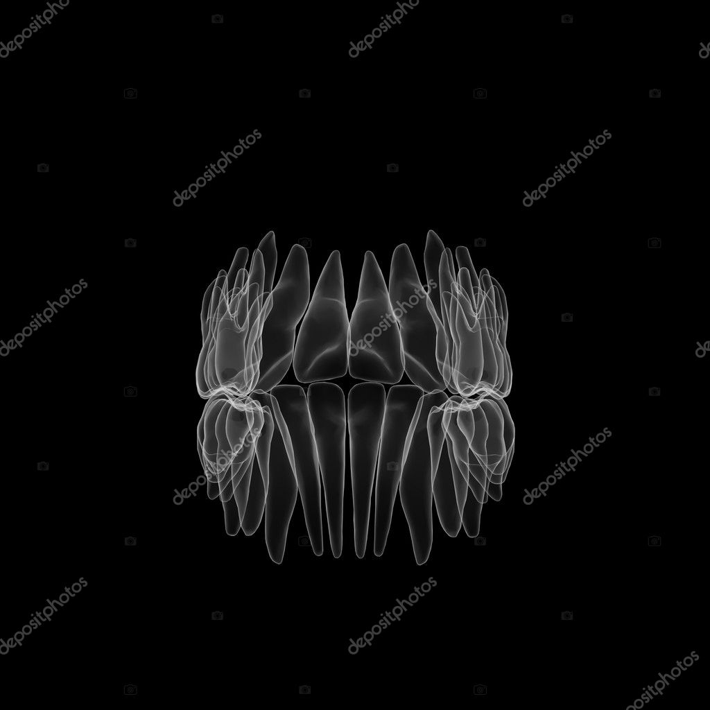 X-ray of Human Teeth — Stock Photo © ingridat #27788683