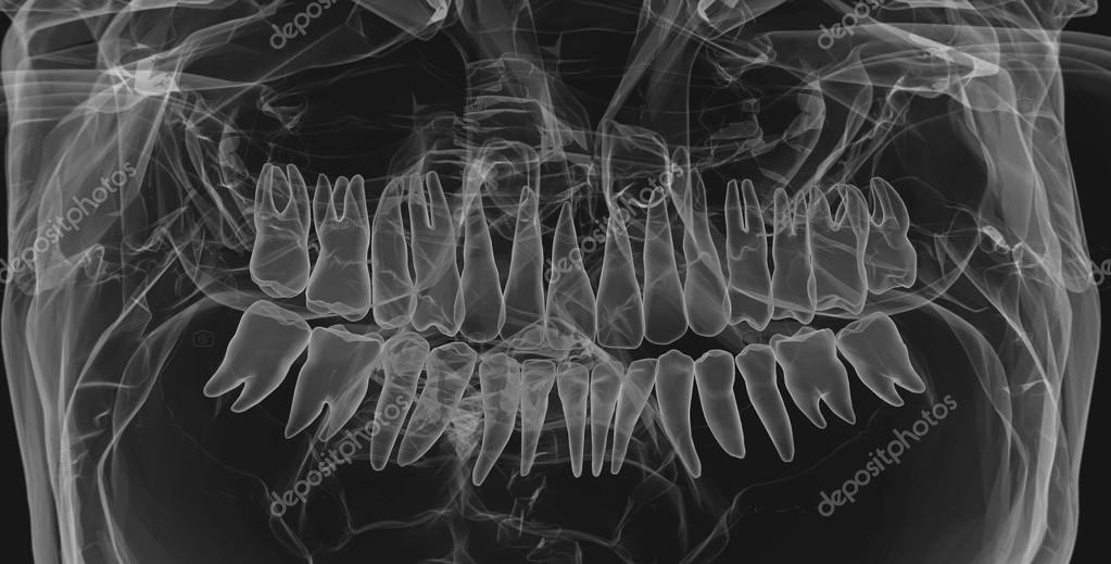 Human Teeth. X-Ray effect — Stock Photo © ingridat #27869741