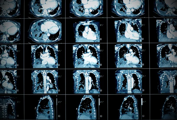 Medical background. CT scan - Stock Image - Everypixel