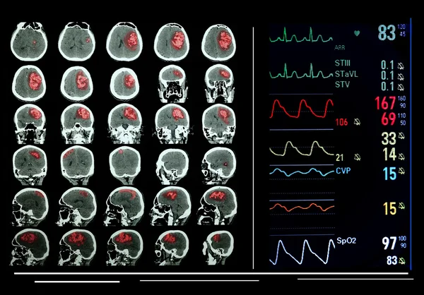 Mri ekg Stock Photos, Royalty Free Mri ekg Images | Depositphotos